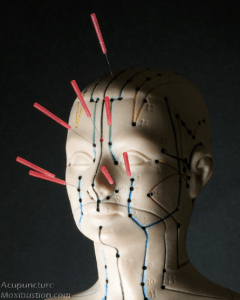 Acupuncture Points