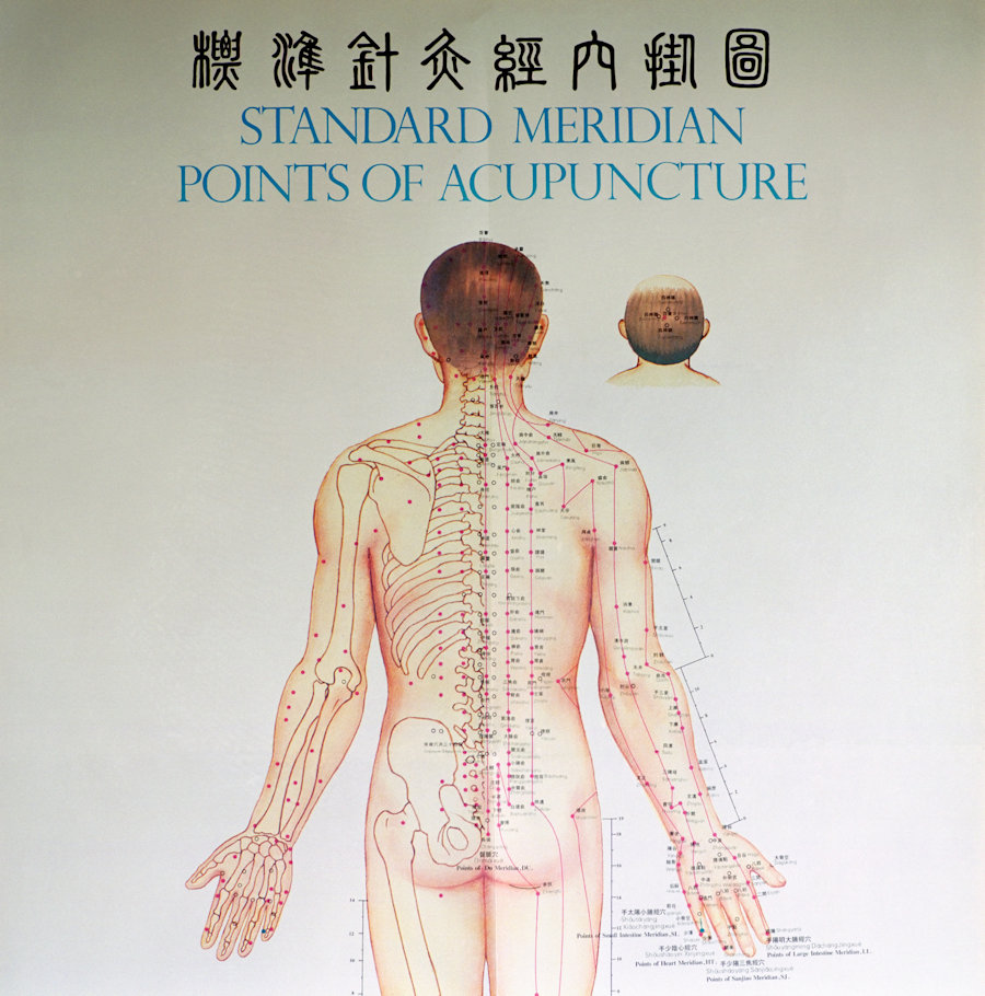 How Acupuncture Works