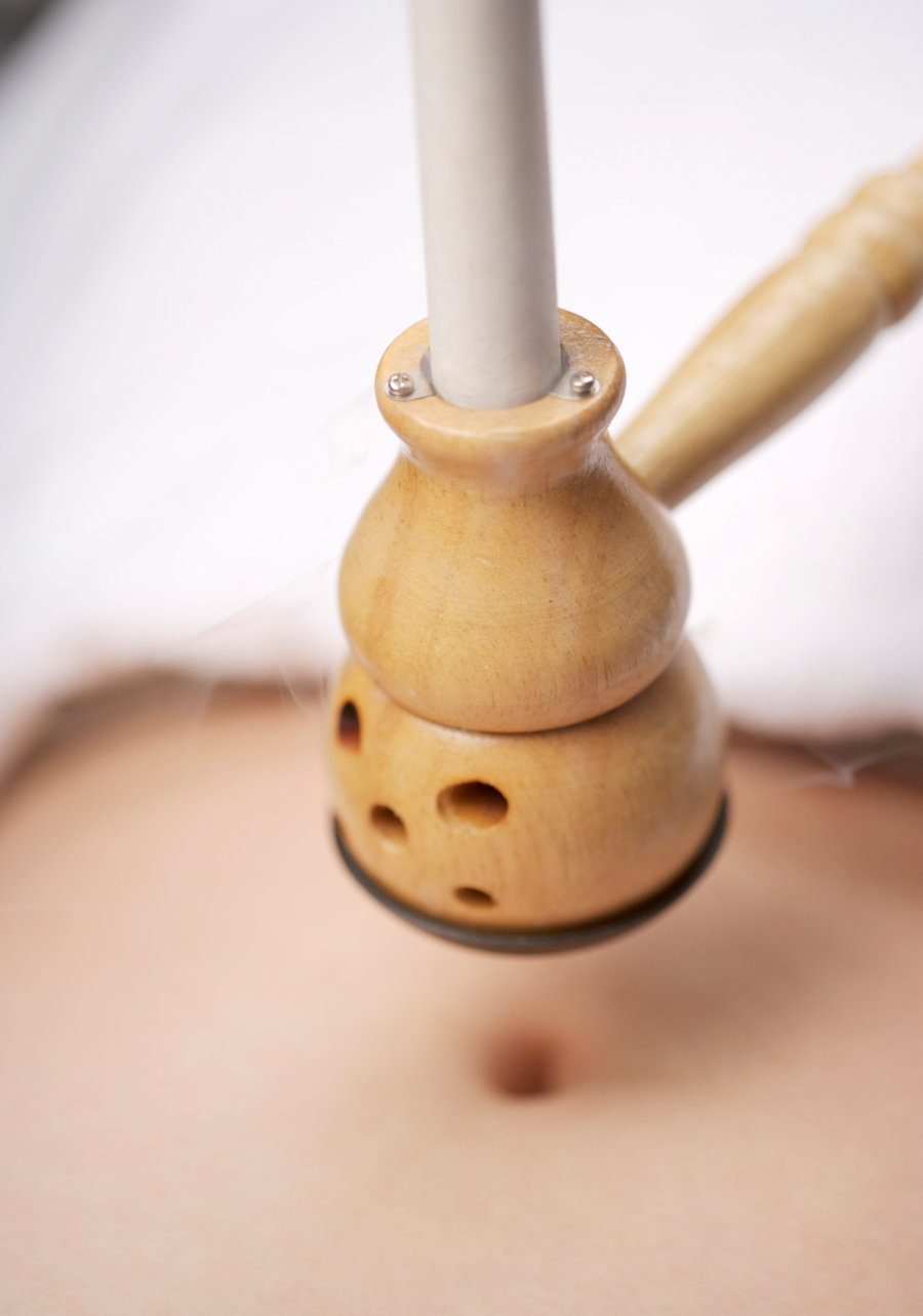 Moxibustion - Moxa Therapy